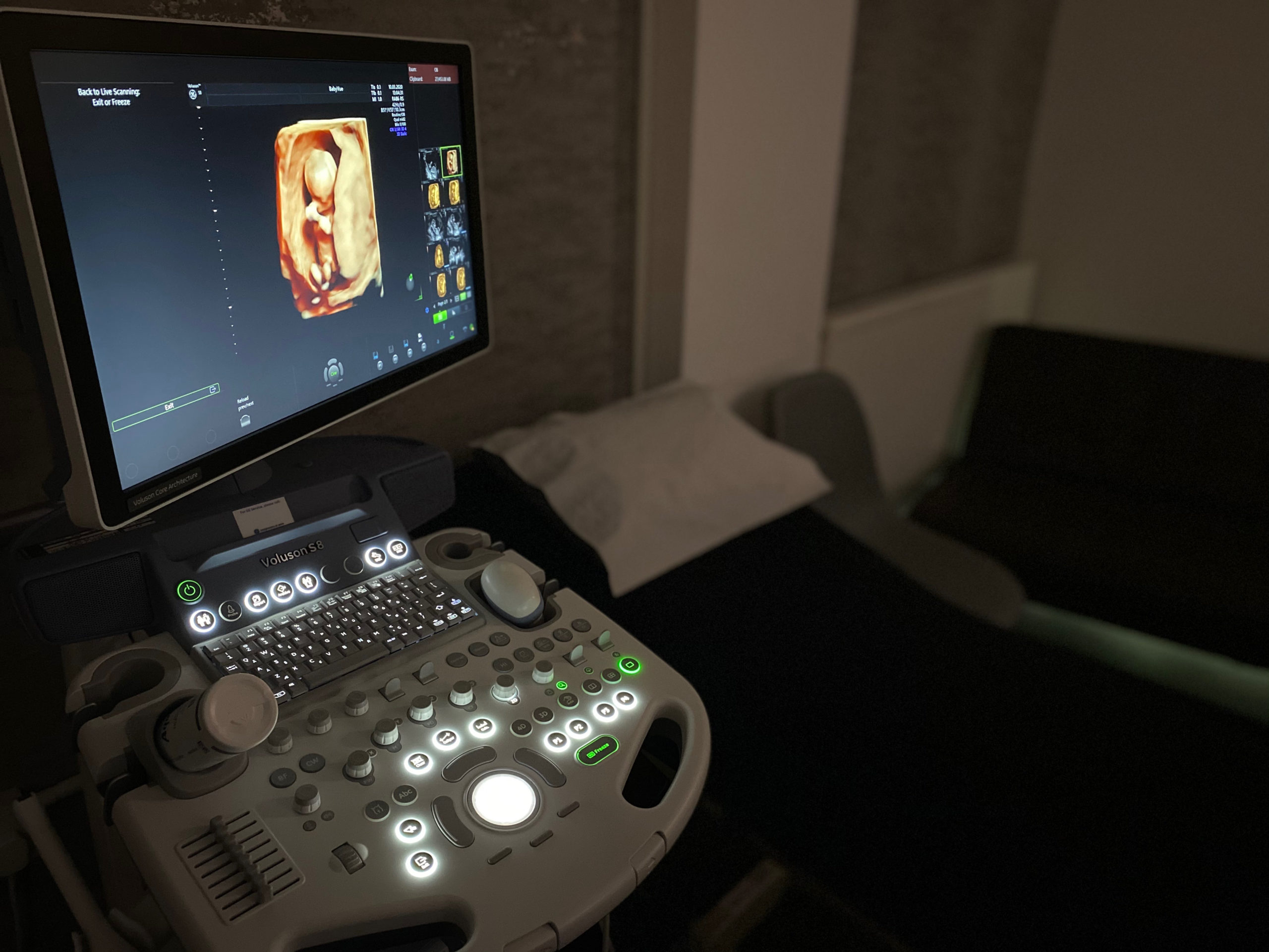 Private Baby Scans Kent Early Pregnancy Gender 4D Scans Private Baby Scans Kent Early Pregnancy Gender 4D Scans